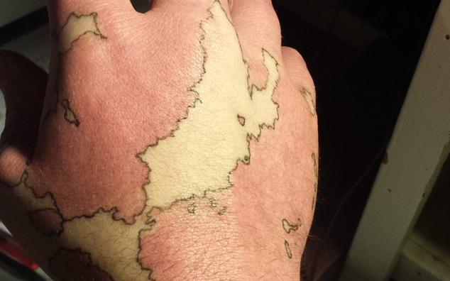 This Guy Transformed His Birthmark Into A Map Of An Imaginary World