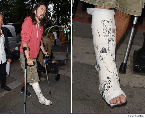 Dave Grohl Falls Off Stage And Breaks His Leg During Live Perfomance
